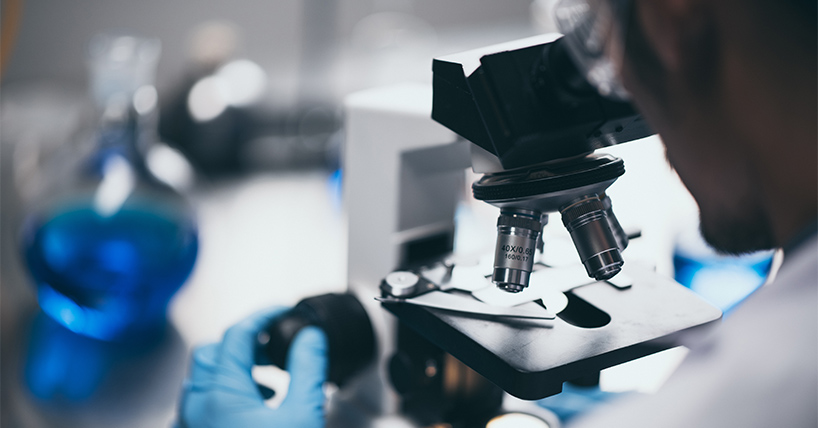 FibroFind - Press Office - Newcastle University